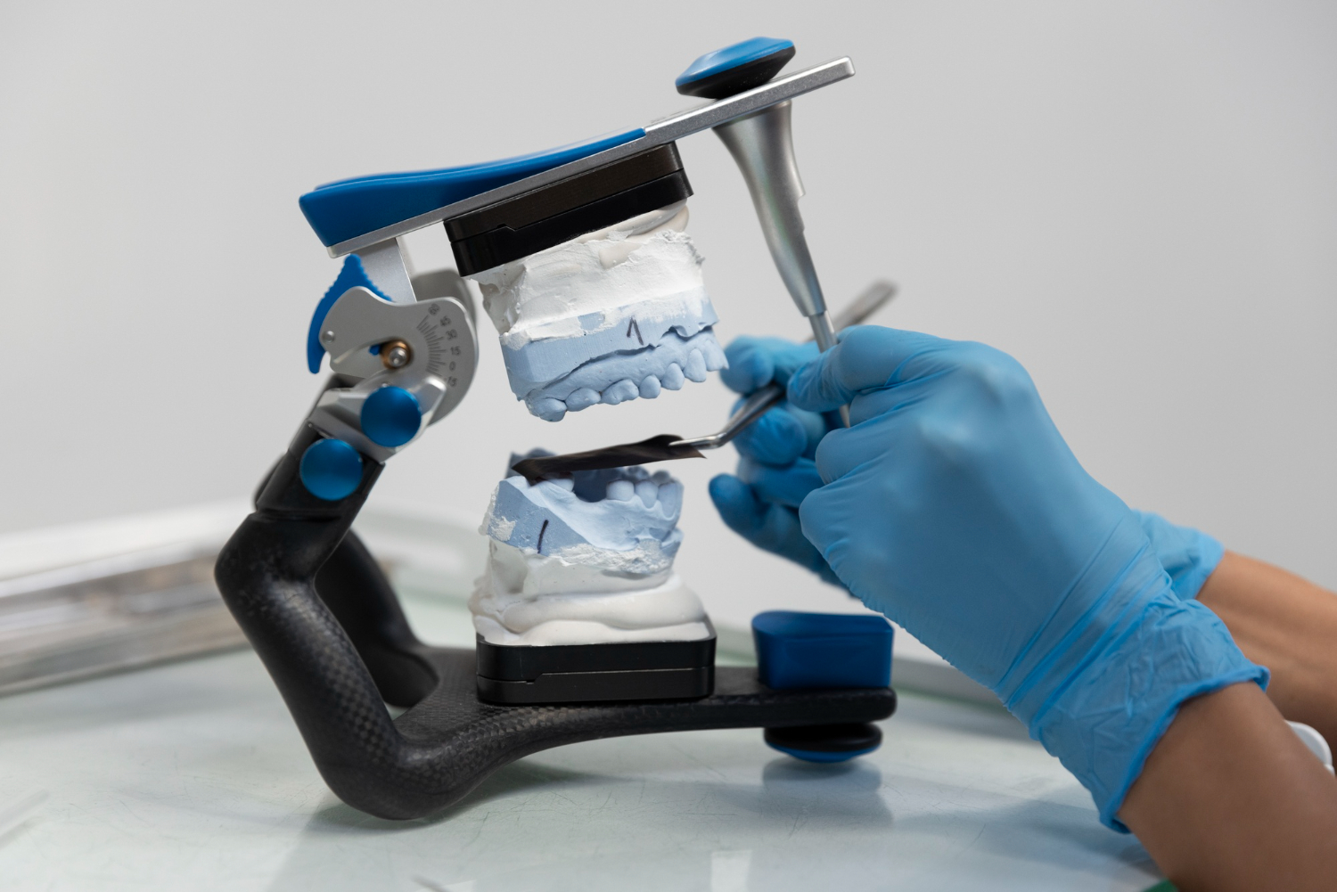 Advancements in Single Dental Implants: A Comprehensive Guide - Megri ...